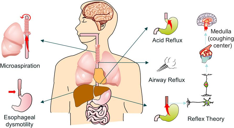 cardiac sphincter problems