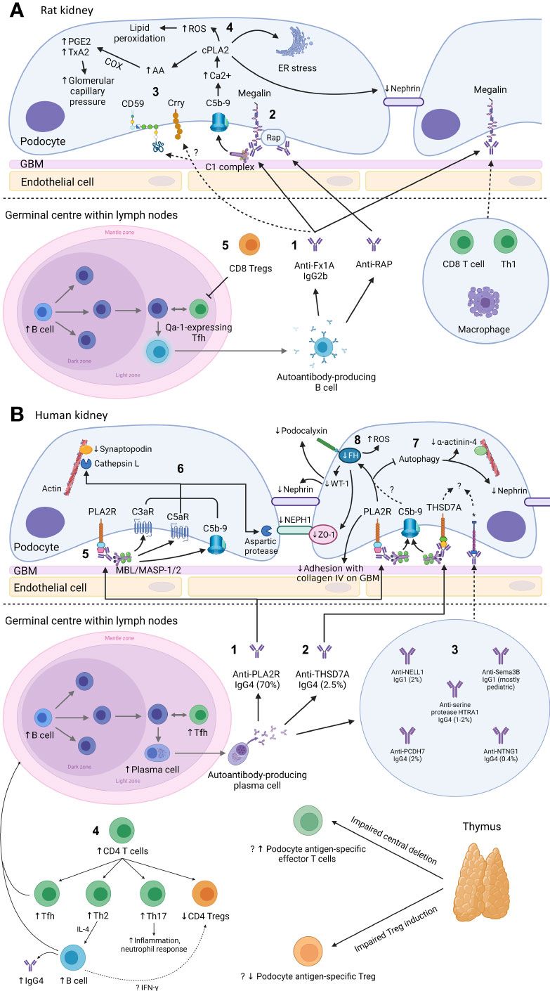 diffuse chronic membranous glomerulonephritis