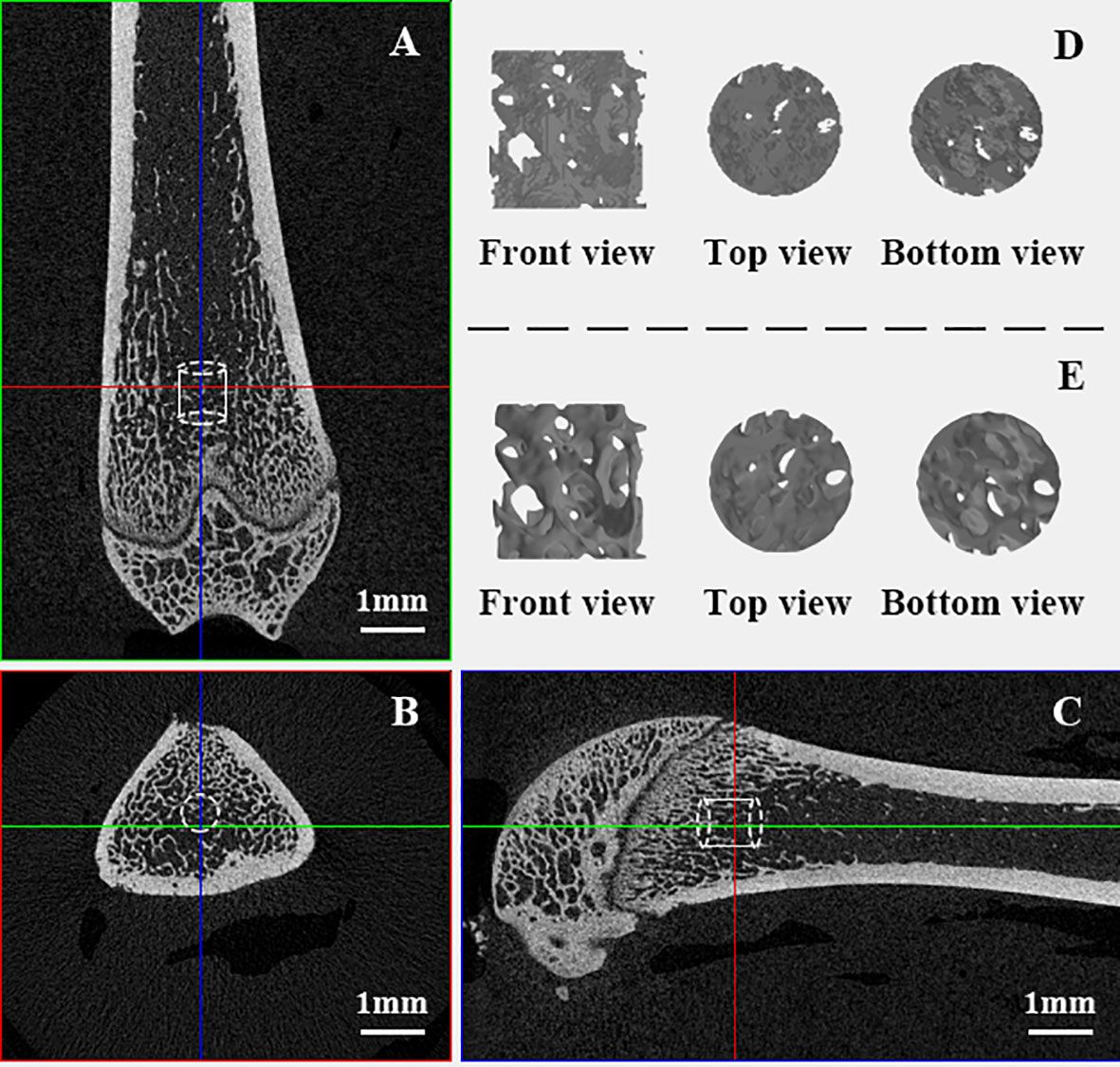 are trabeculae thick or thin