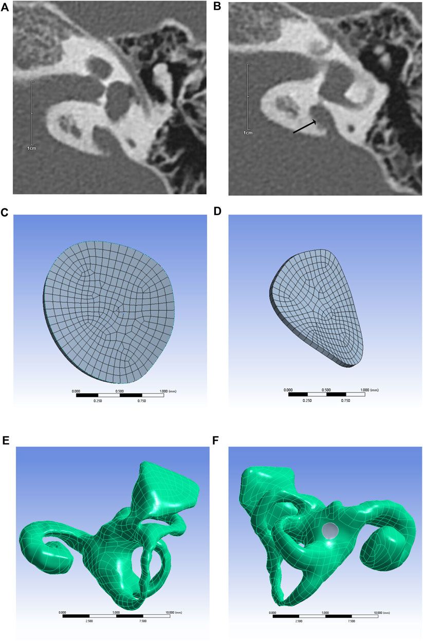 vestibular aqueduct function