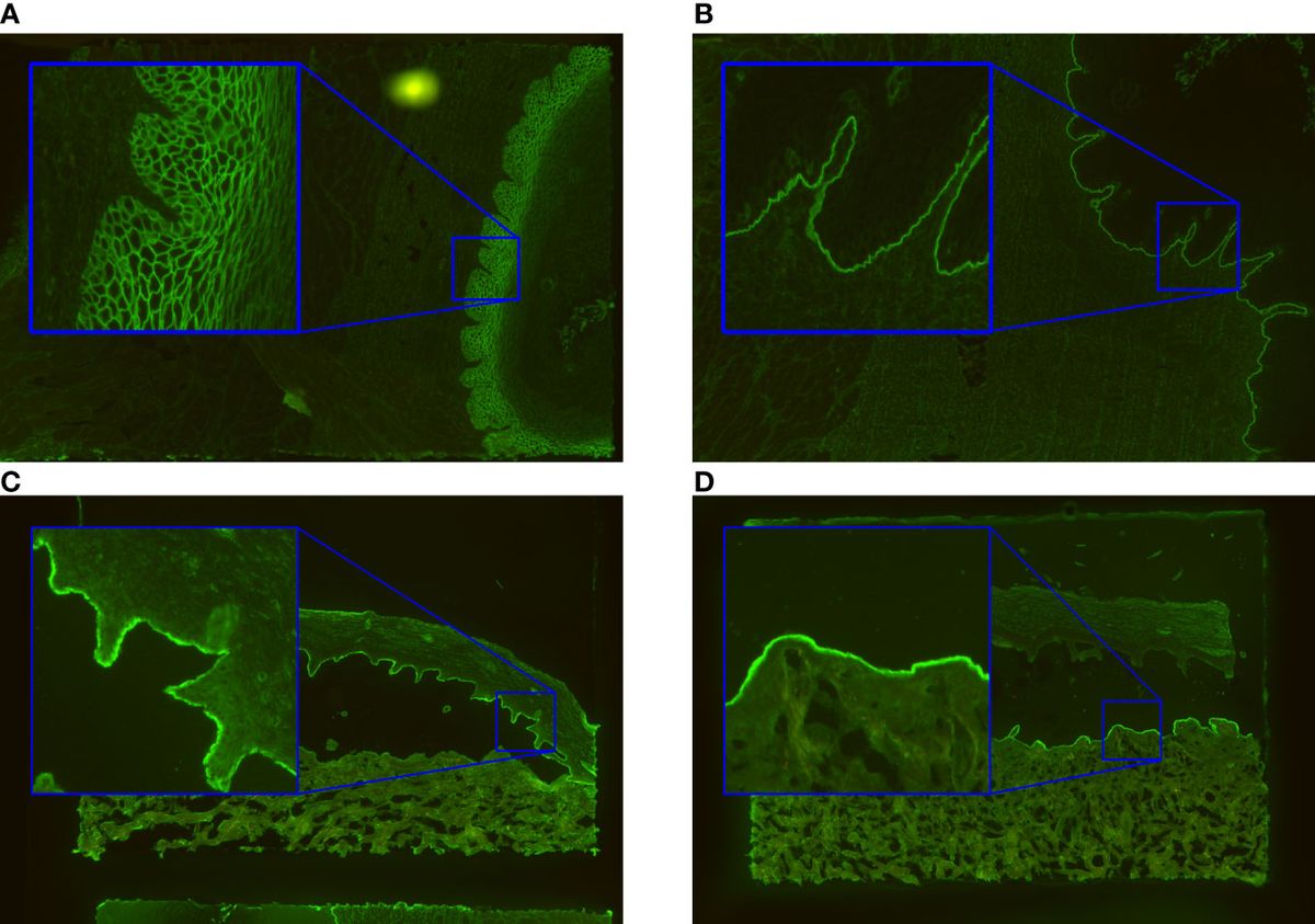 pemphigoid immunofluorescence pattern
