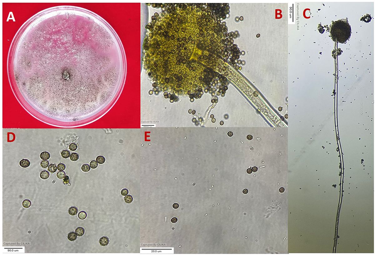 aspergillus microscope view