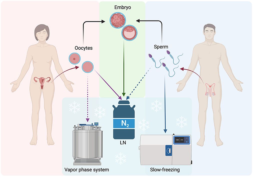 oocyte cryopreservation