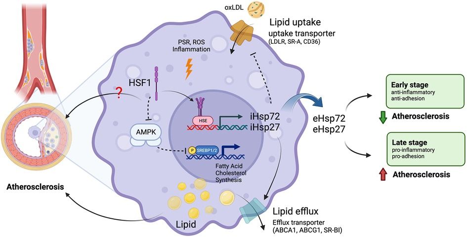 atherosclerosis pathogenesis calgary