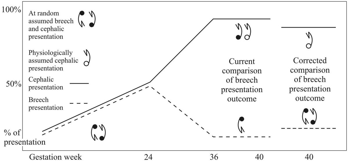 how does prematurity cause breech presentation