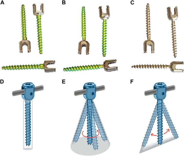 pedicle screw