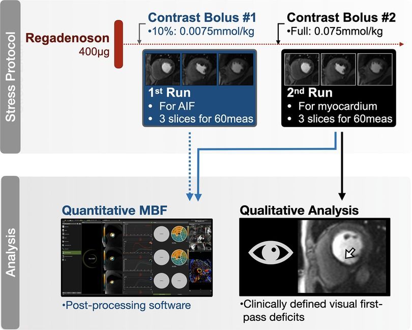 subendocardial hypoperfusion