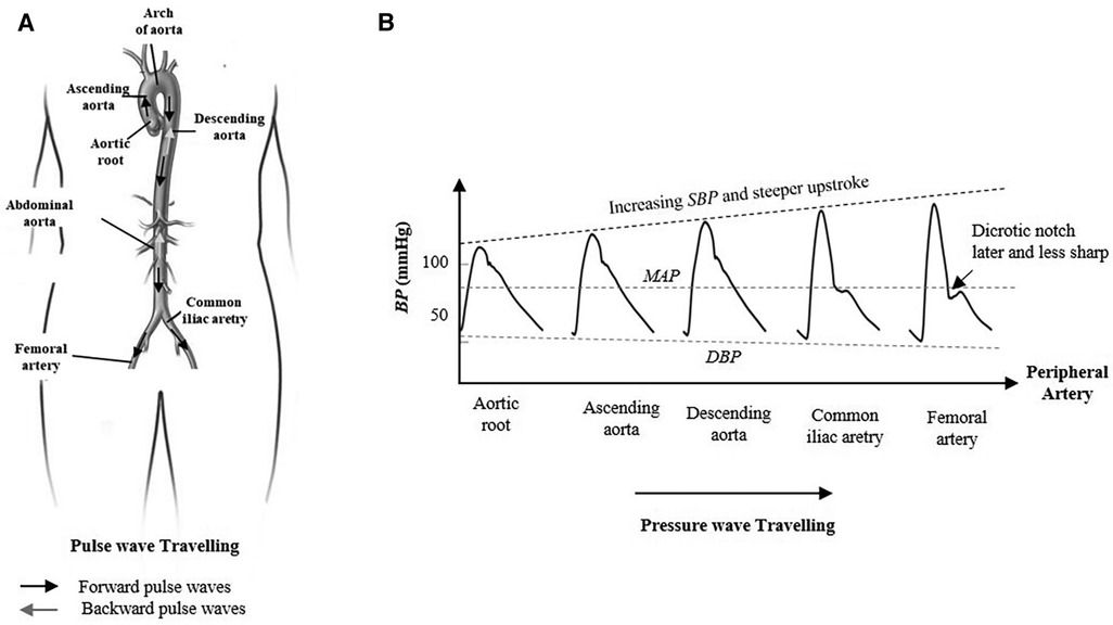brachial pulse shape
