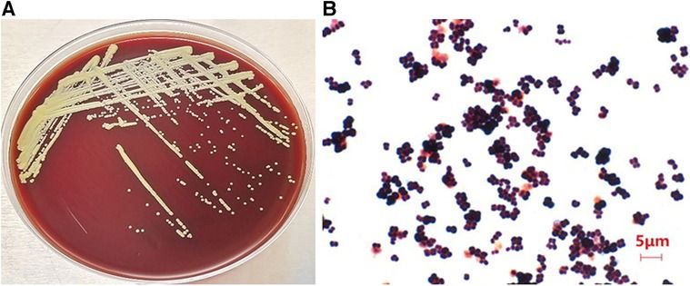 micrococcus luteus staphylococcus