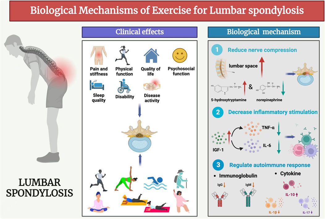 disc herniation exercises