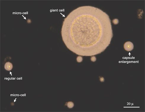 cryptococcosis structure