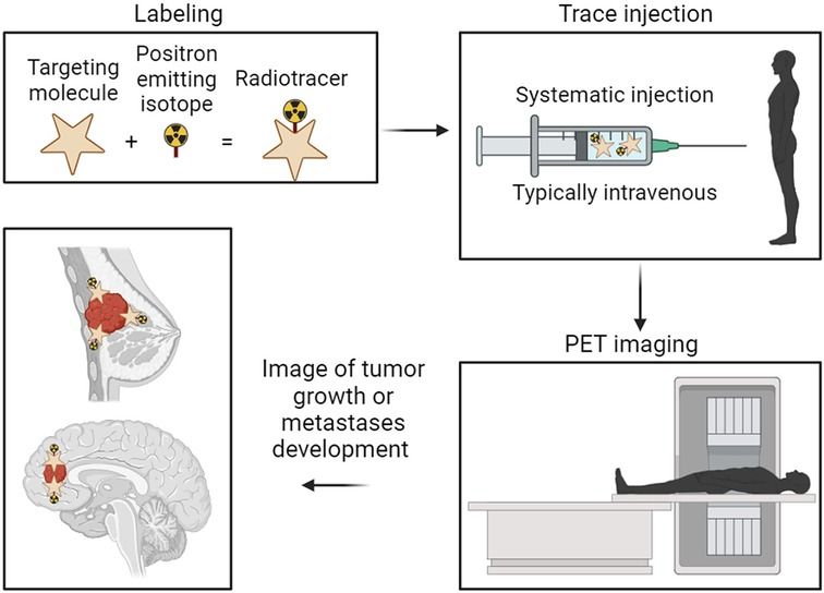 radioisotope injection