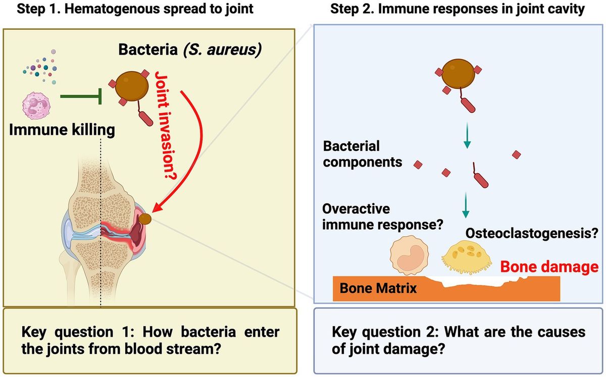 microbial arthritis