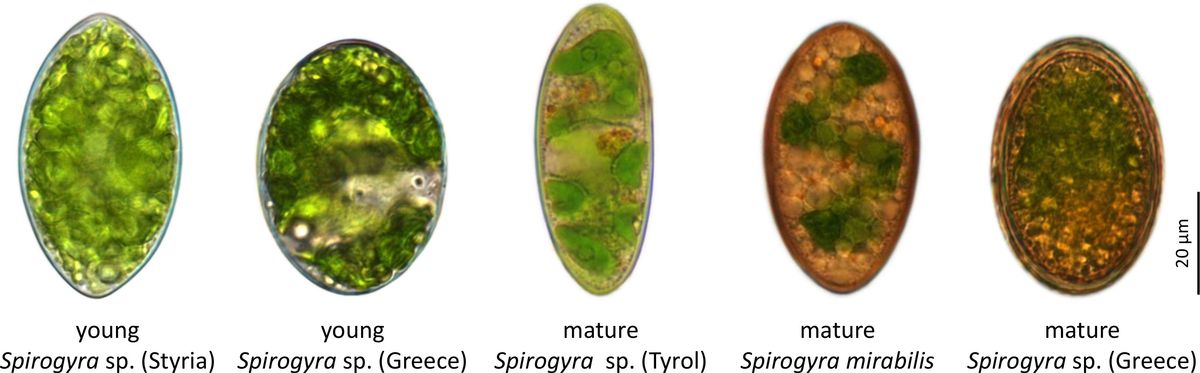 spirogyra cell shape