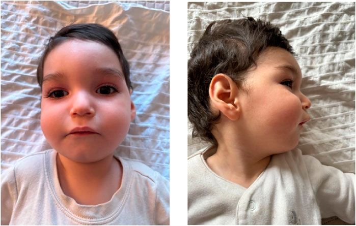 asphyxia disease in hindi