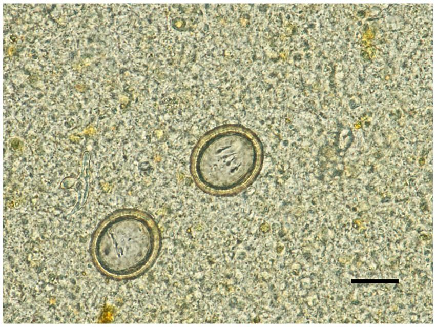 Echinococcus Ova