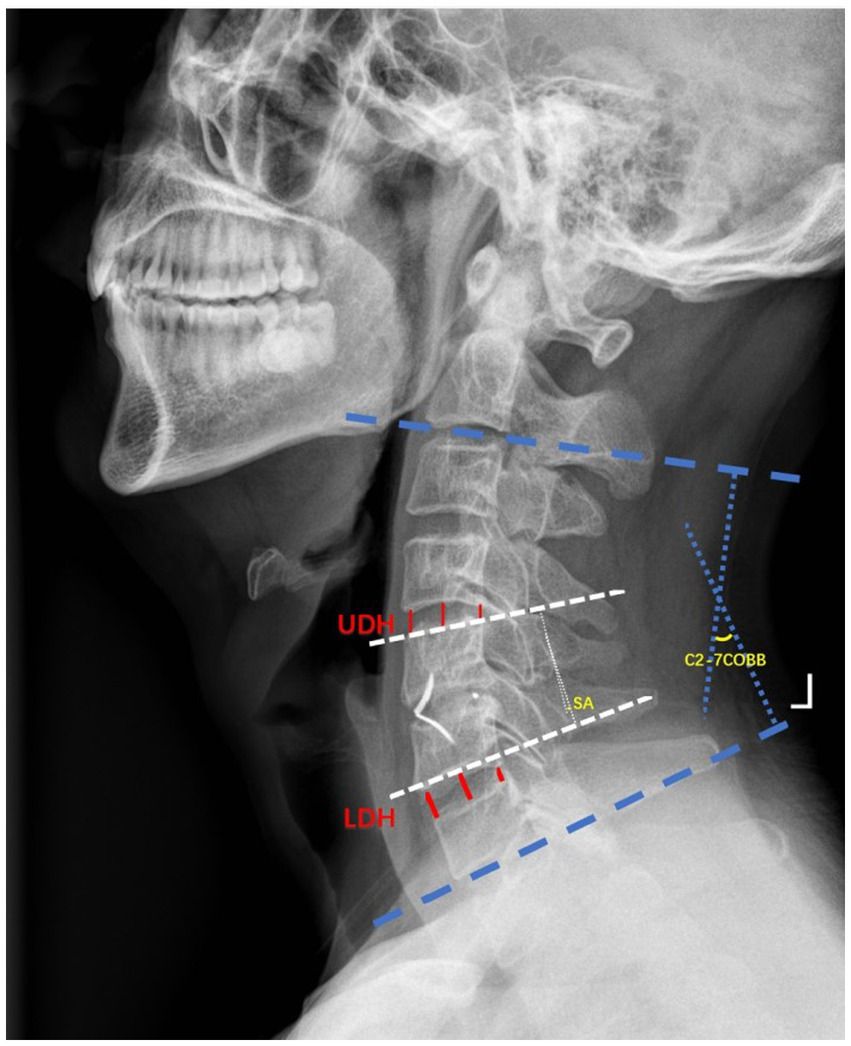 space between cervical vertebrae