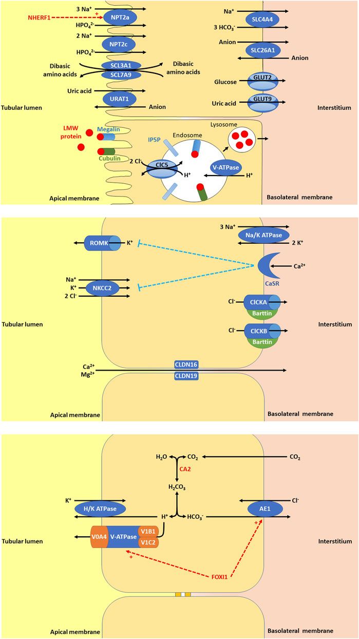 nephrocalcinosis pathophysiology