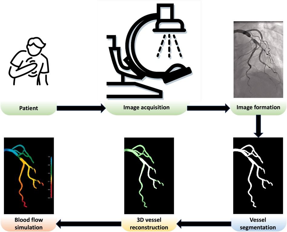 blood vessel simulation