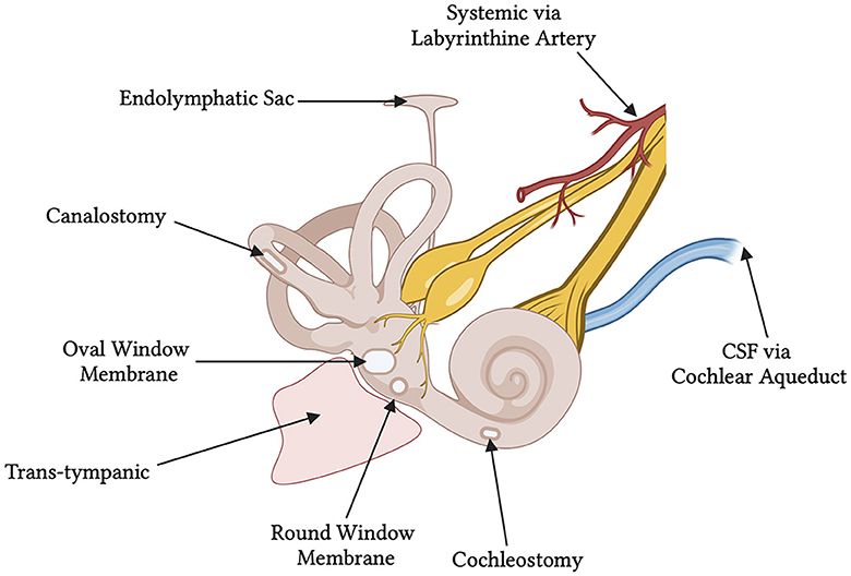 is partial deafness hereditary