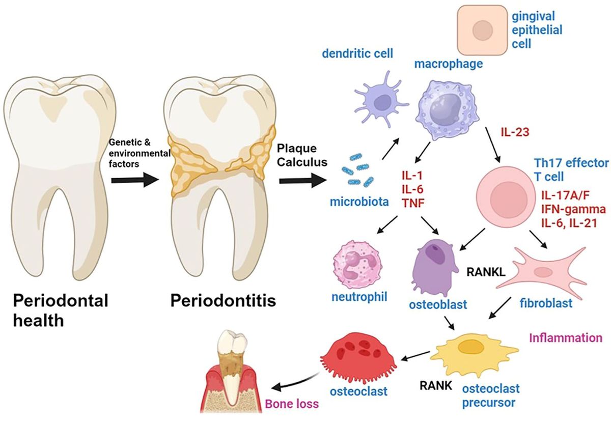 fibrotic gingivitis