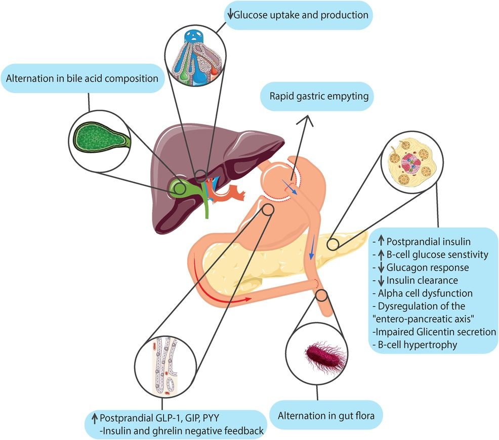 partial gastrectomy icd 10