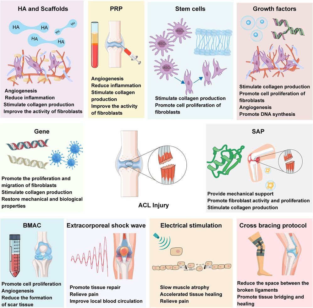 blueprint arthro complete