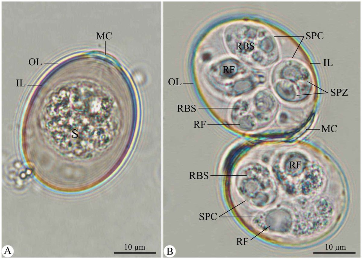 coccidia eggs under microscope