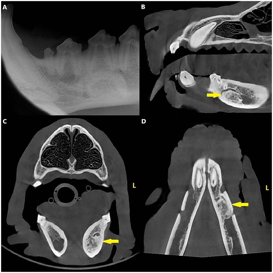 condensing osteitis radiology