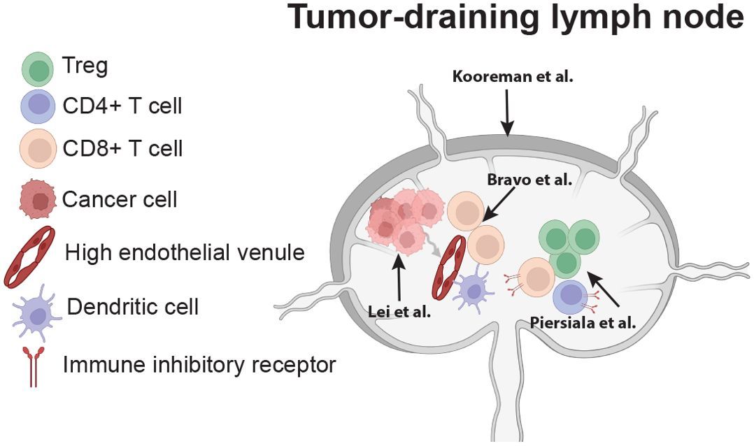 lymph node cancer