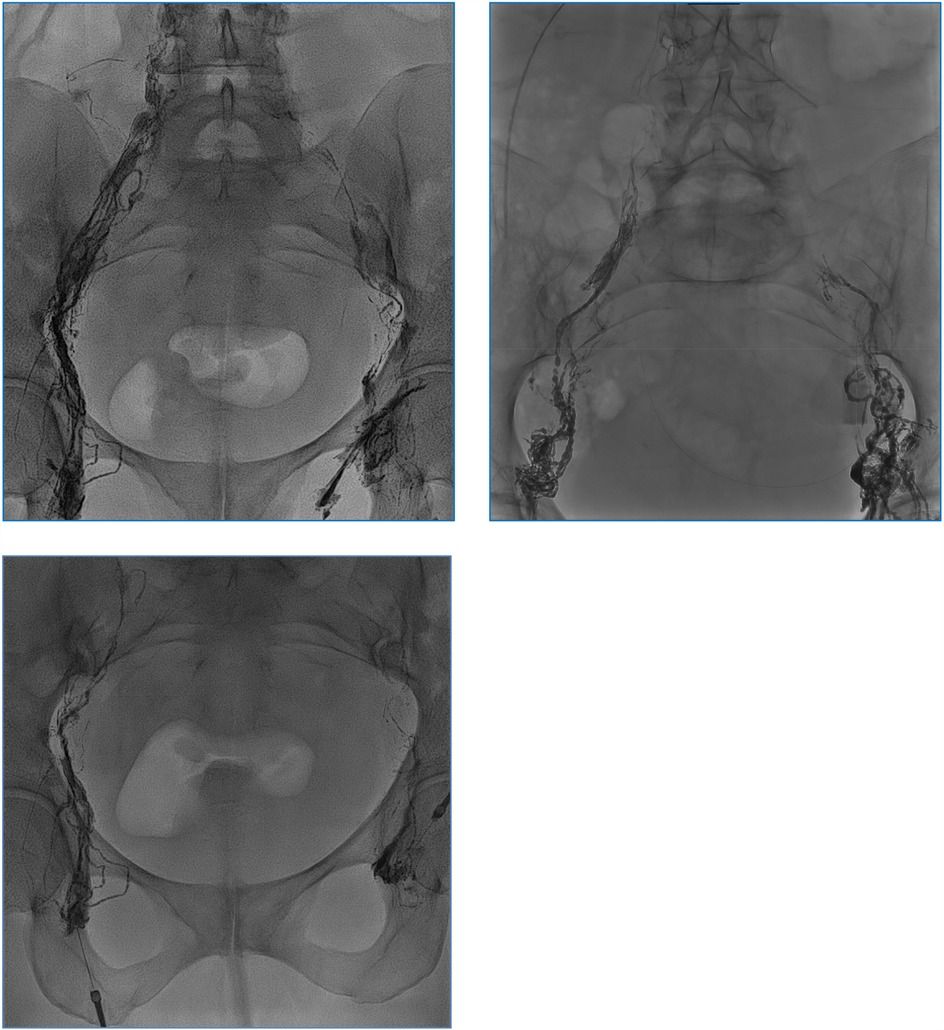 wolfgang strobel block