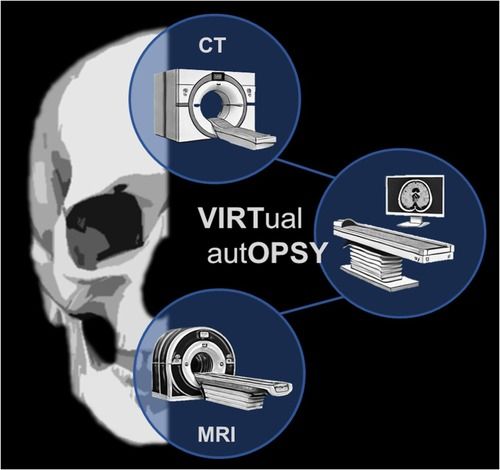 forensic autopsy examples