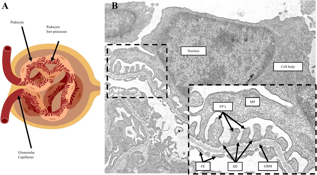 podocyte adaptations