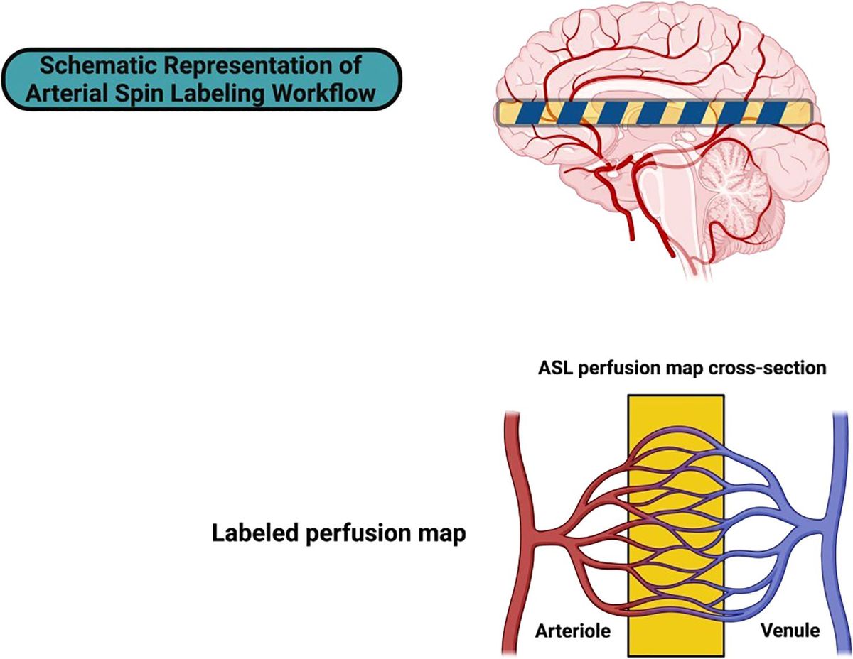 sphenoid release technique