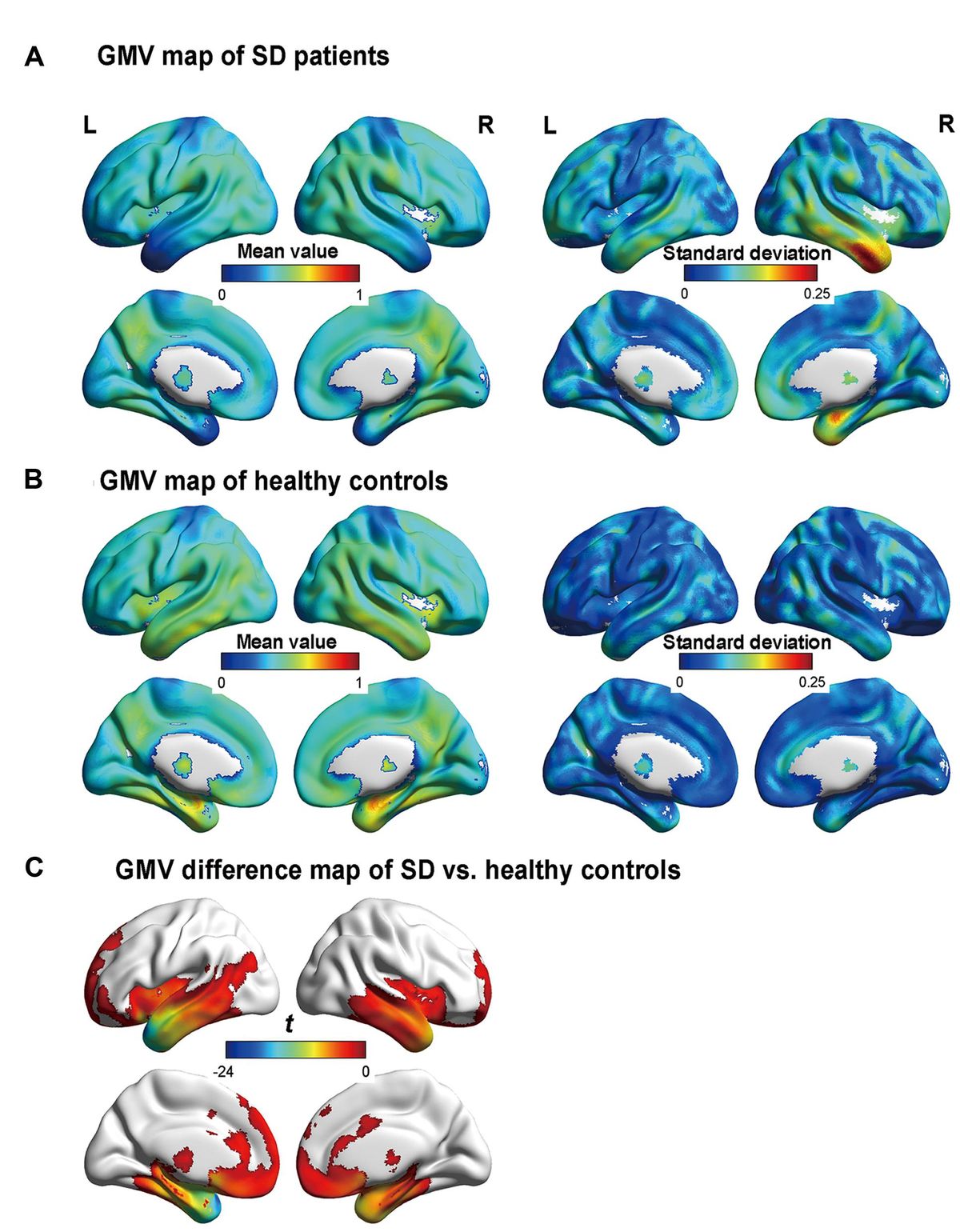 fusiform gyrus coronal