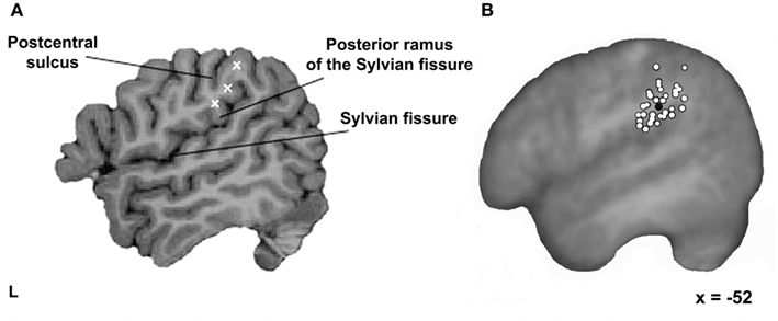 supramarginal gyrus and angular gyrus function