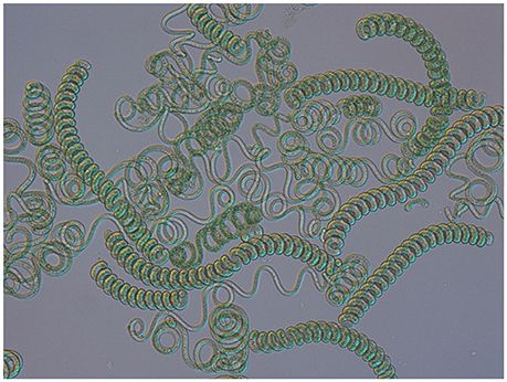 spirulina bacteria examples