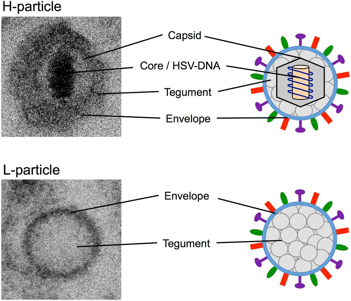 herpes virus simplex