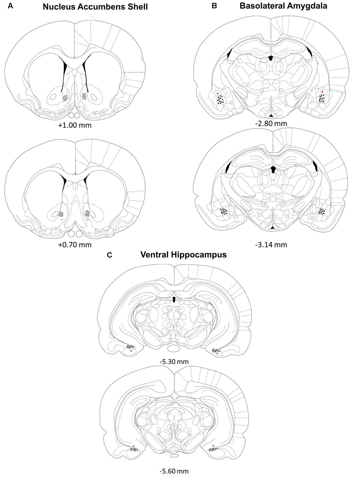nucleus accumbens coronal section