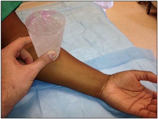 cold urticaria foundation