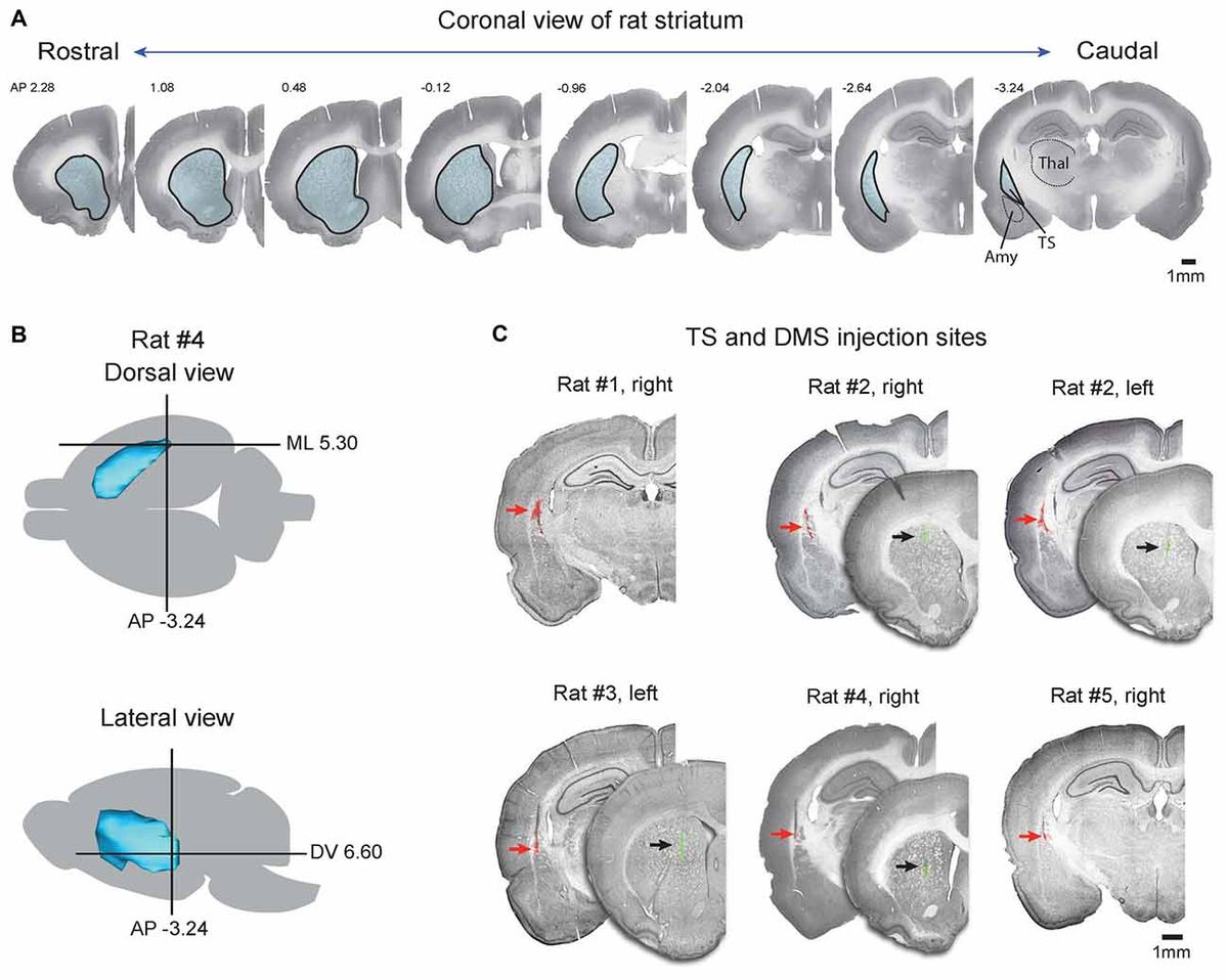 dorsal striatum function