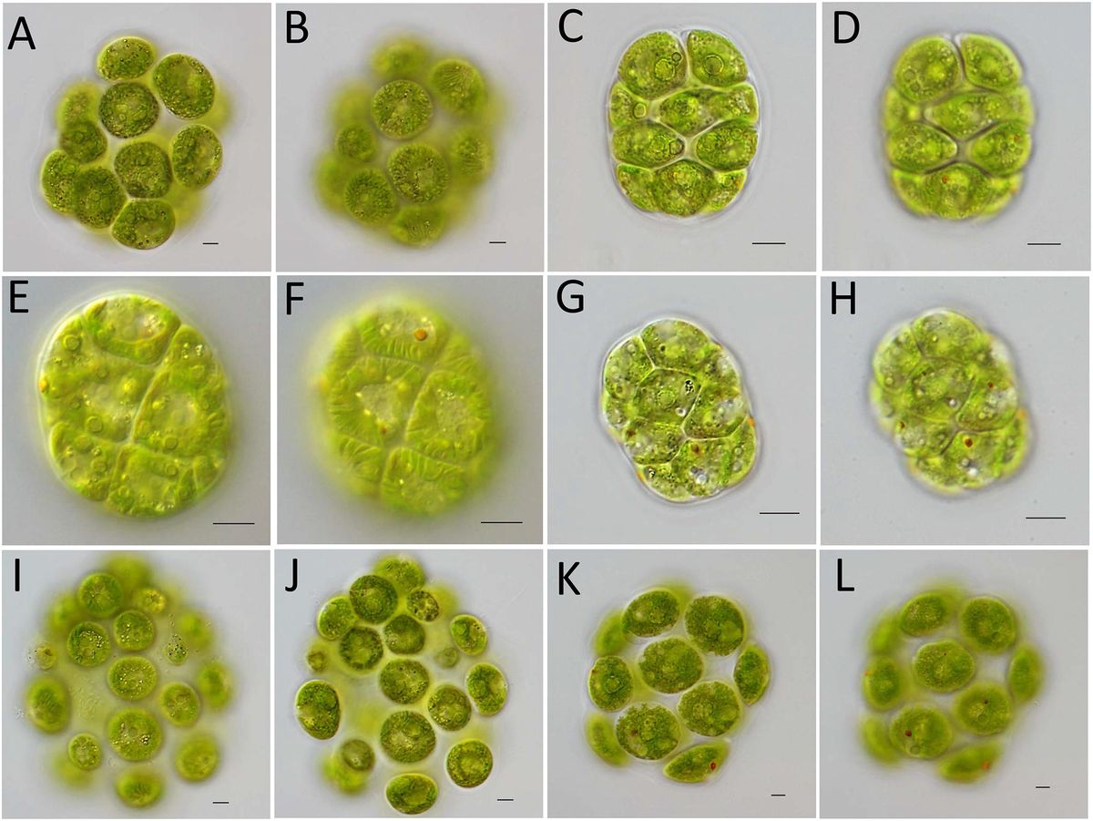 gonium under microscope labeled