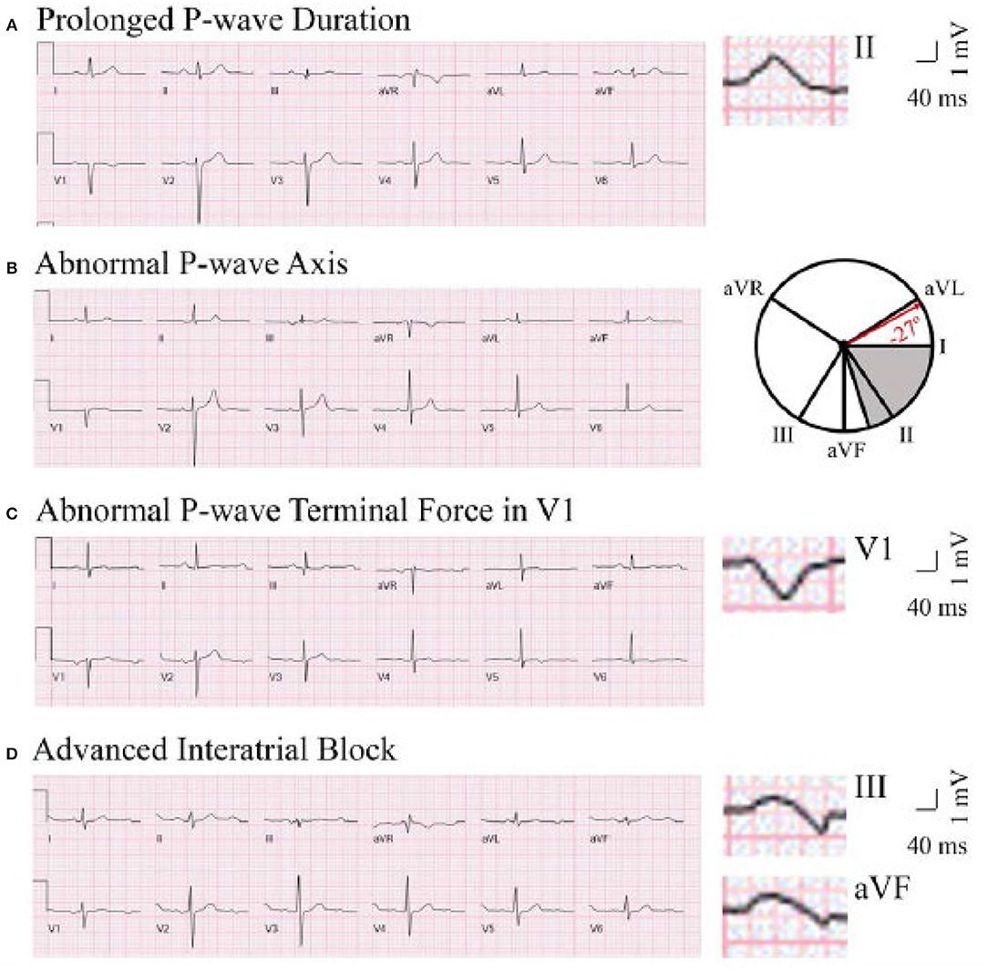 p wave description
