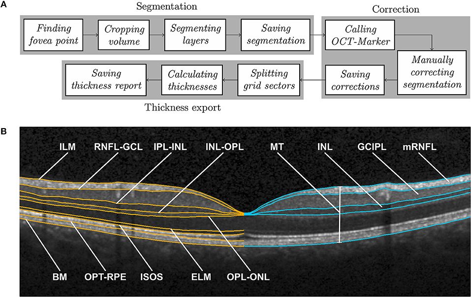 fovea layers