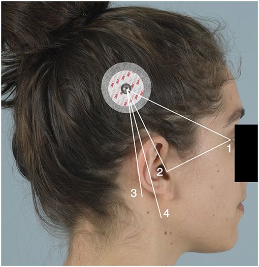 cochlear implant hearing loop
