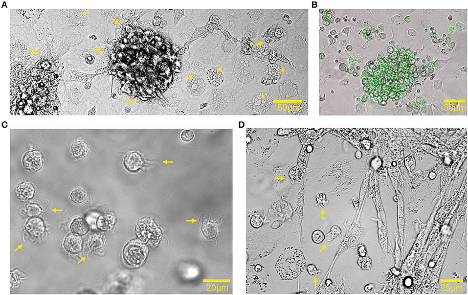 dendritic cell under microscope