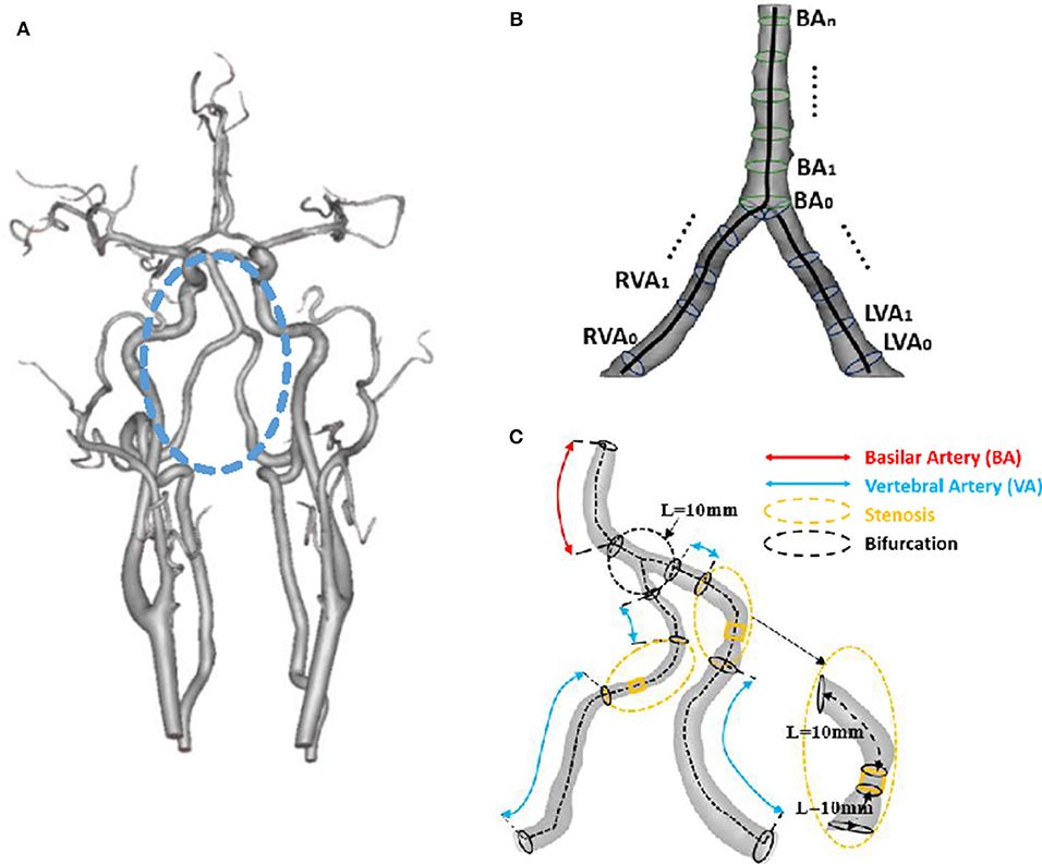 vertebral artery