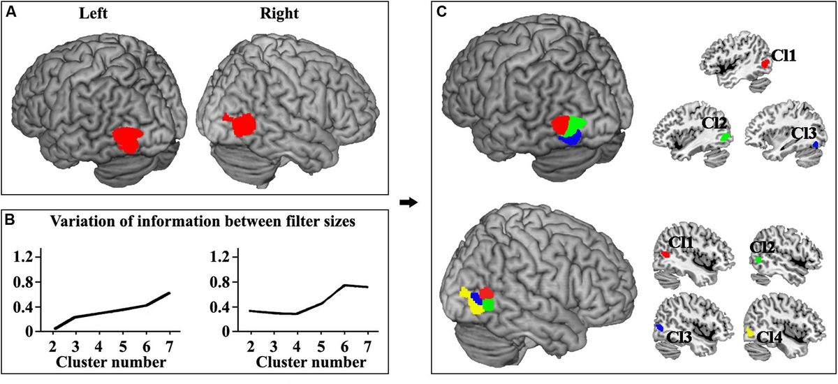 middle temporal region