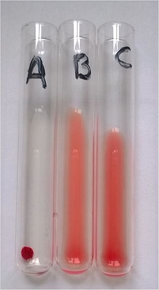 agglutination test example