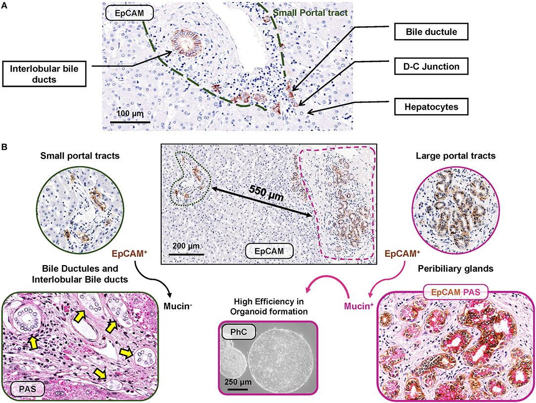 interlobular bile duct